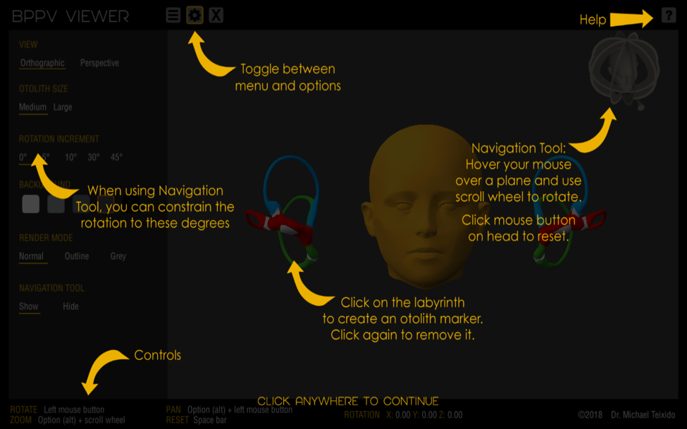 BPPV Viewer – BPPV Visualization with a 3D Model for Study and Teaching ...
