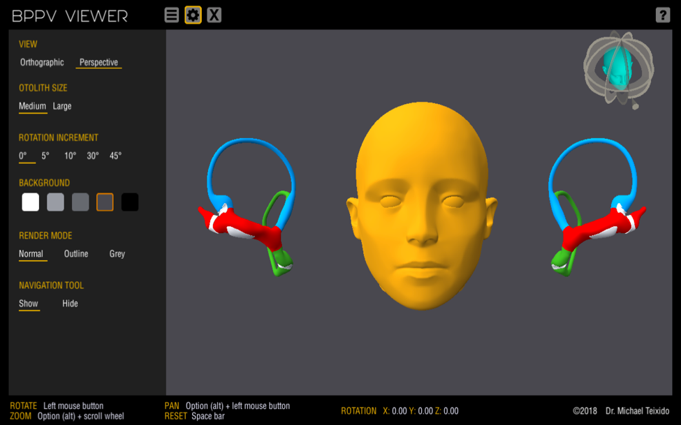 BPPV Viewer – BPPV Visualization with a 3D Model for Study and Teaching ...
