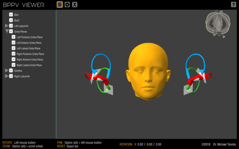 BPPV Viewer – BPPV Visualization with a 3D Model for Study and Teaching ...