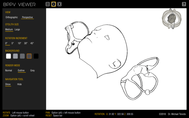 BPPV Viewer – BPPV Visualization with a 3D Model for Study and Teaching ...