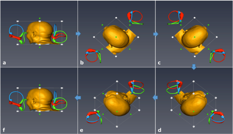 3D Model Simulations – BPPV Viewer