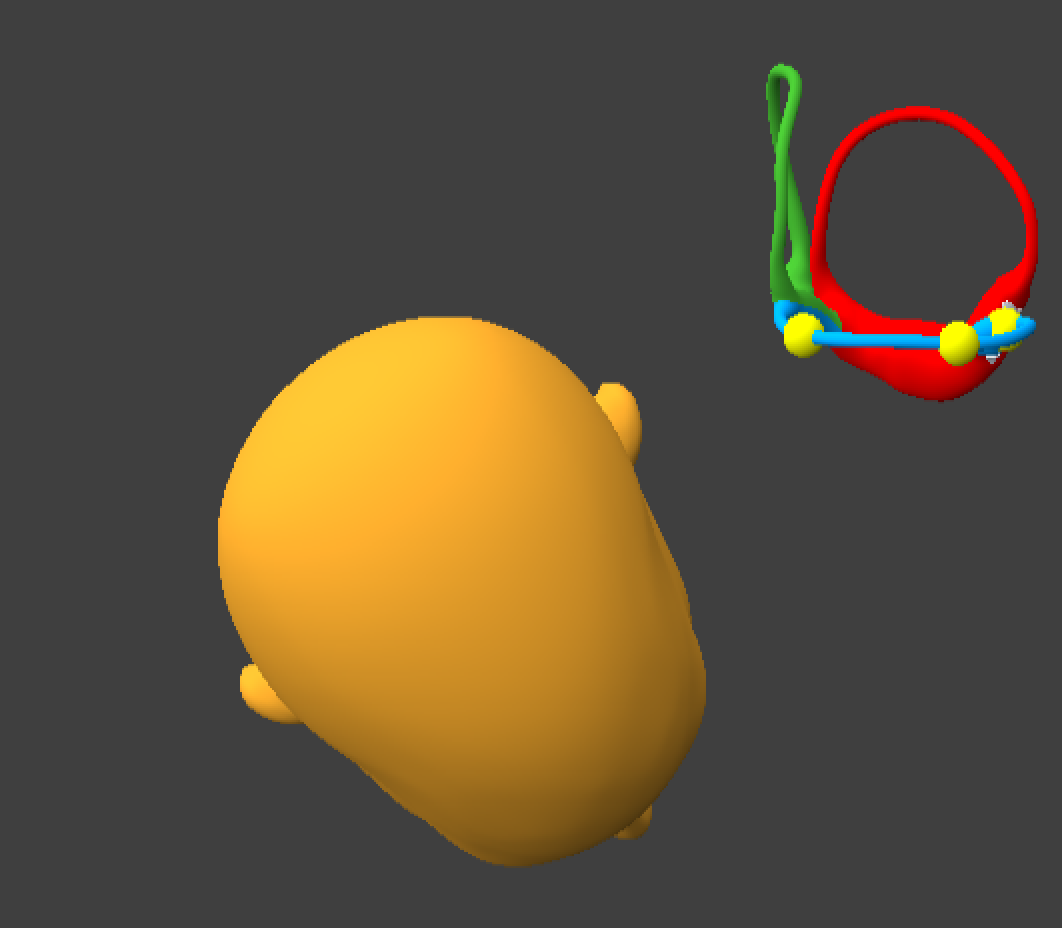 3D Model Simulations – BPPV Viewer